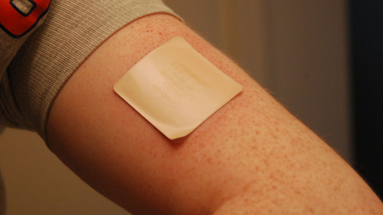 Skin patch dissolves 'lingering fat' | The Guardian Nigeria News ...