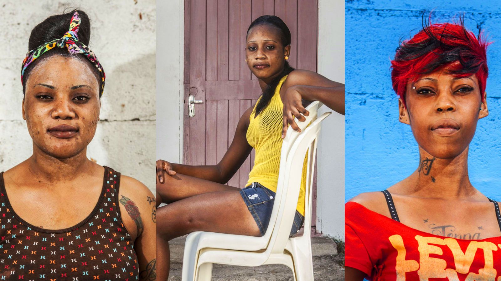 3 Health Hazards Of Skin Bleaching