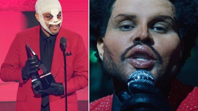 The Weeknd Uses Botox Prosthetics In Music Video