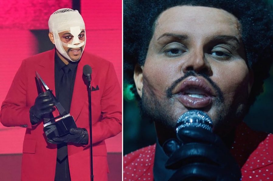 The Weeknd Uses Botox Prosthetics In Music Video