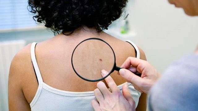 6 Skin Conditions That Are Signs Of Serious Health Issues