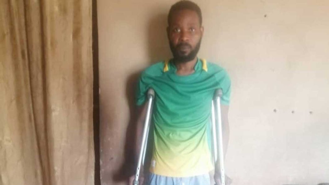 Sulaimon seeks N2.5m to treat giant cell tumor | The Guardian Nigeria ...