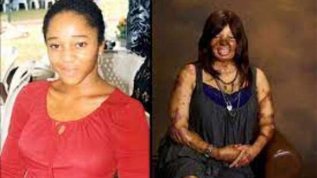 Sosoliso plane crash: Okwuchi marks 19 years of survival, dedicates ...