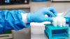 NBS reports drop in diagnostic accuracy among health workers